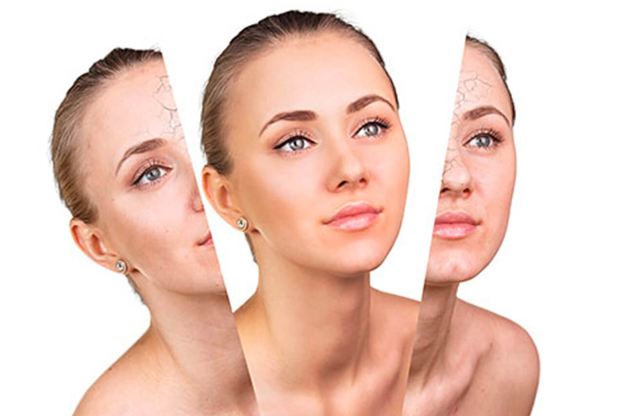 Sciton ProFractional™ Resurfacing | Haydel Dermatology